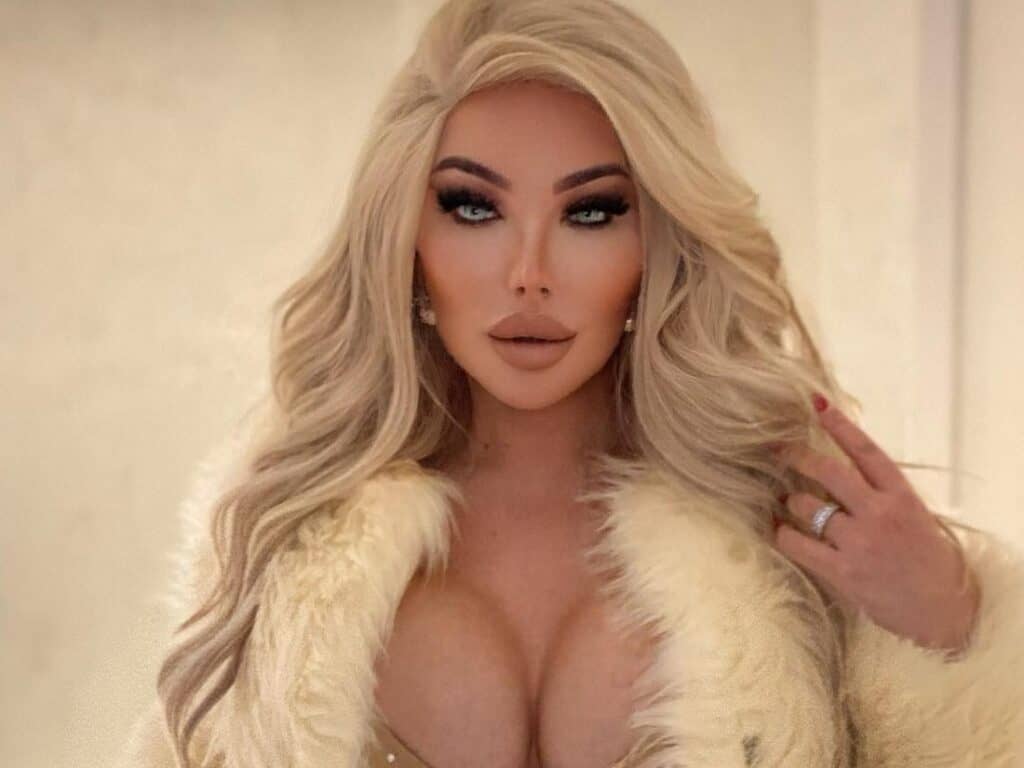 Jessica Alves realiza novo procedimento estético após quase perder o nariz; Confira - Ecos da ...